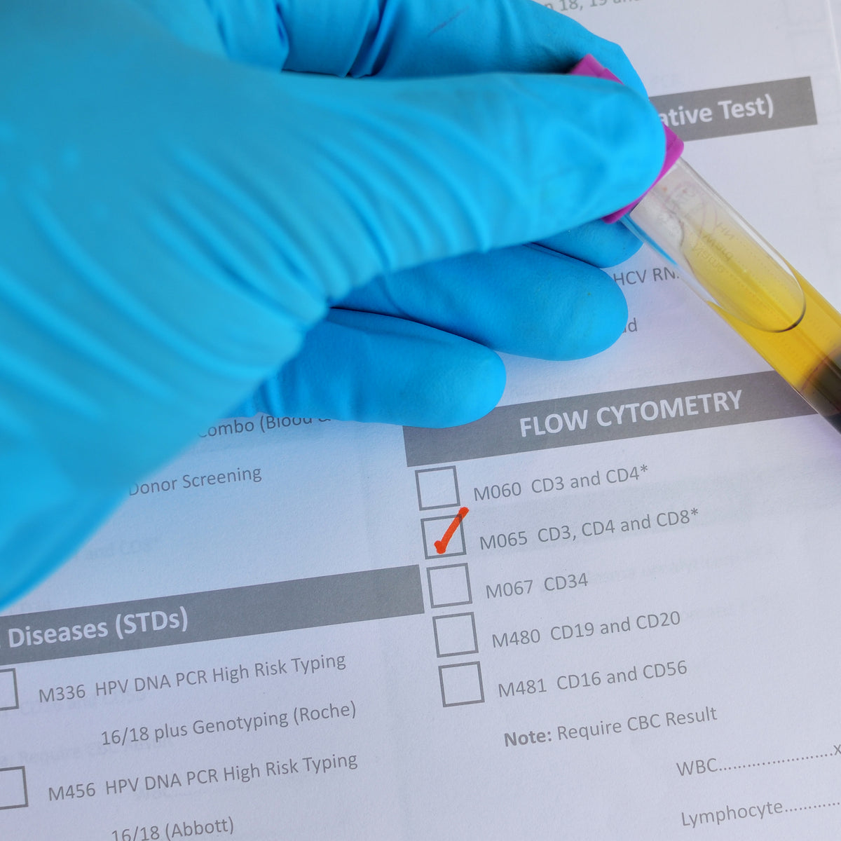 What Is Urodynamic Testing Understanding Different Types And Their Us