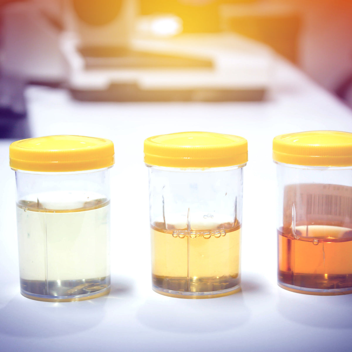 How to Interpret Urine Color: Your Health Indicator – Because